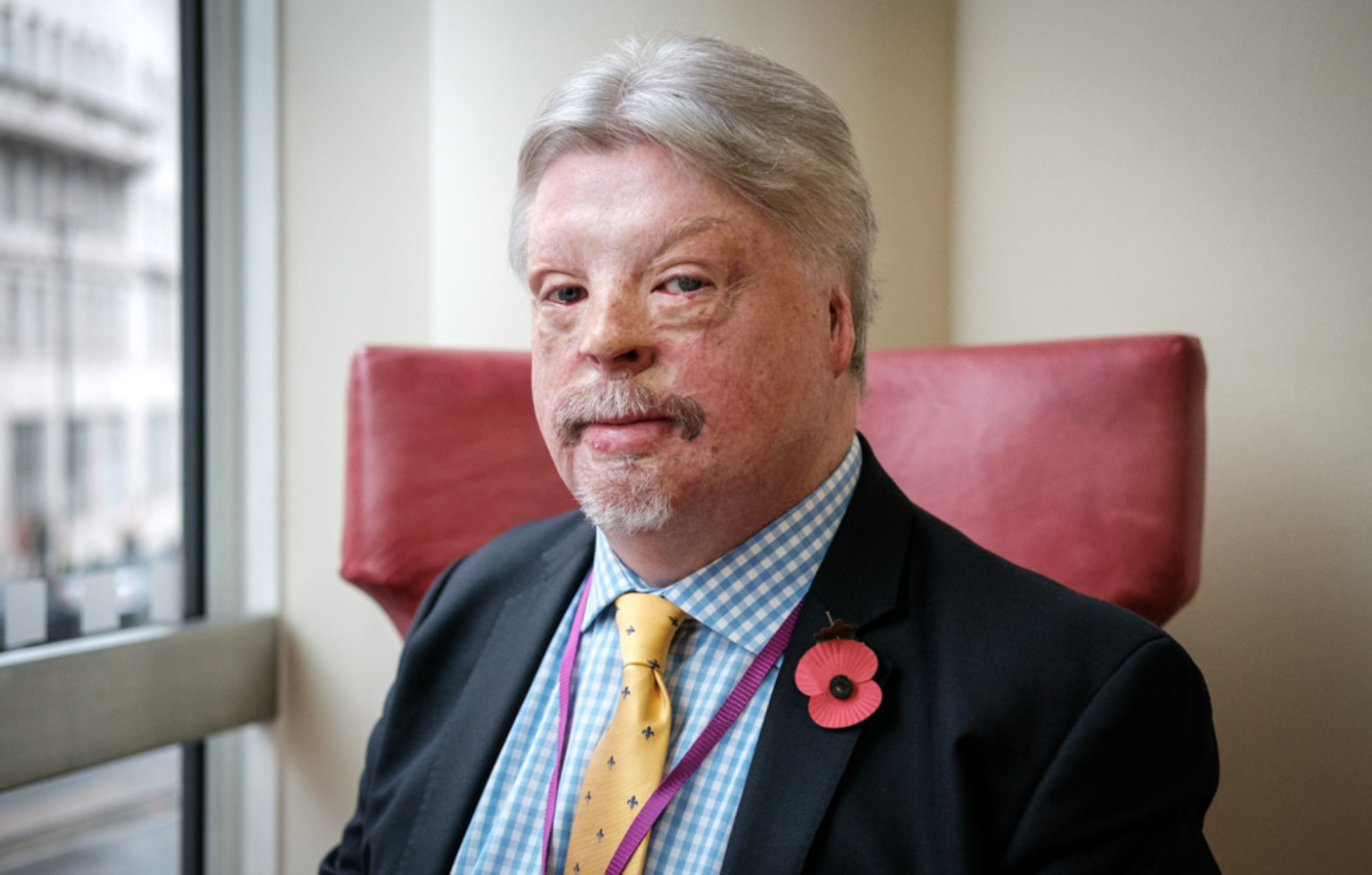 Simon - The Scar Free Foundation