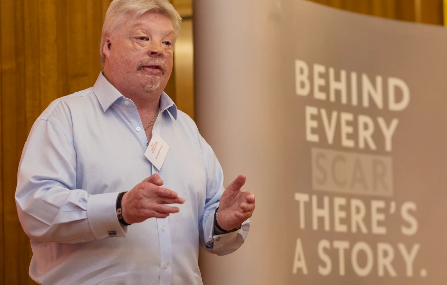 Simon - The Scar Free Foundation