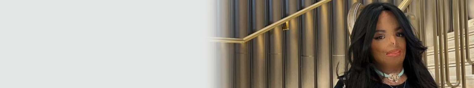 Aleema - The Scar Free Foundation