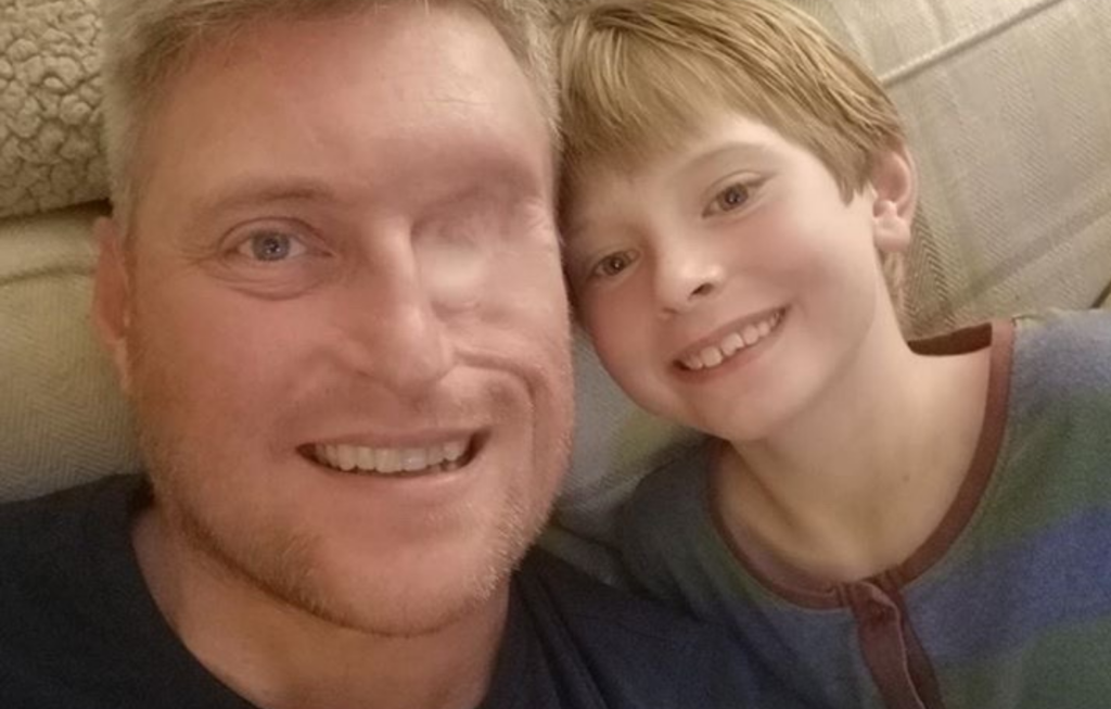 Living with Scars - The Scar Free Foundation