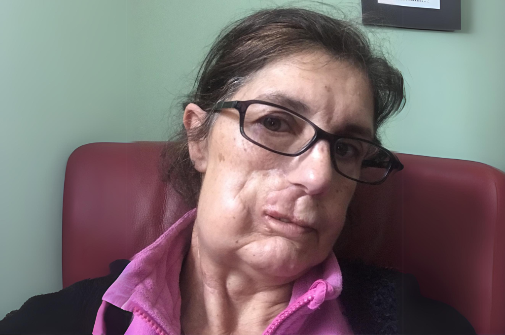 Living with Scars - The Scar Free Foundation