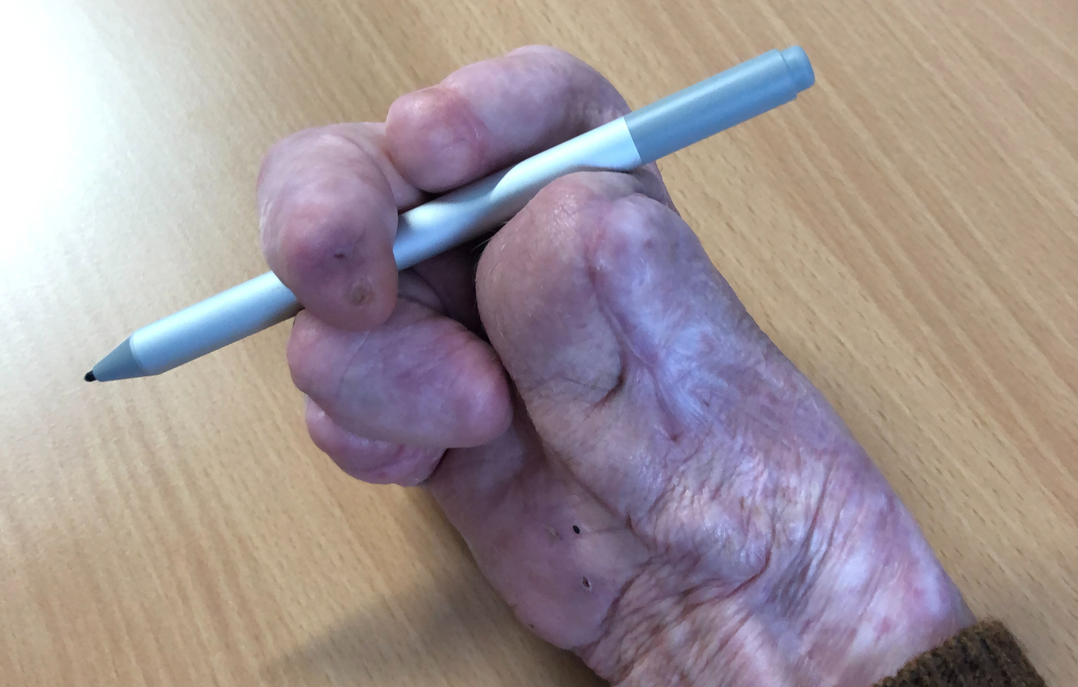 Living with Scars - The Scar Free Foundation